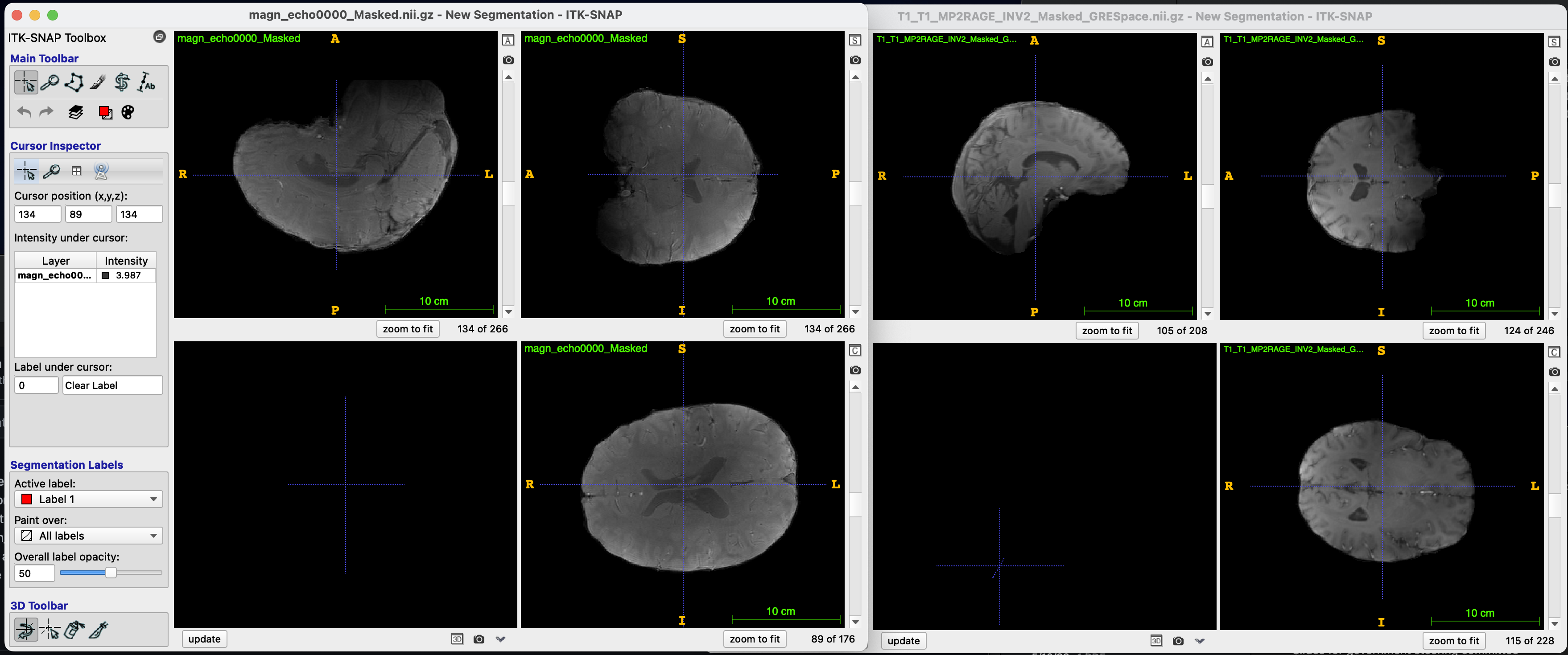 Affine registration of T1 to T2star (Brain MRI) Problem · Issue #403 ...