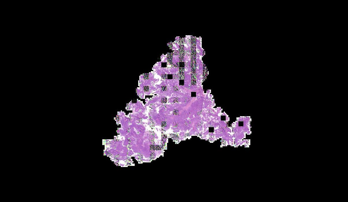 Using the Pipeline on MRXS format Whole Slide Images · Issue #86 ...