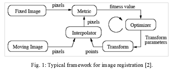 GitHub - kamruleee51/Intensity-Based-MRI-Registration: Image ...