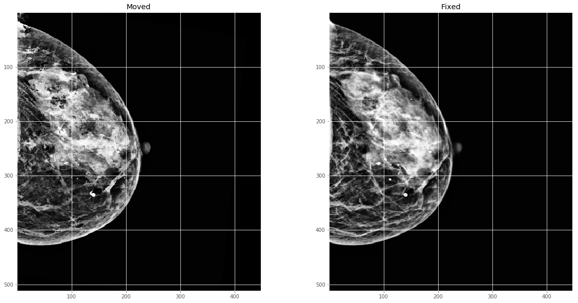 Registering mammograms · Issue #51 · voxelmorph/voxelmorph · GitHub