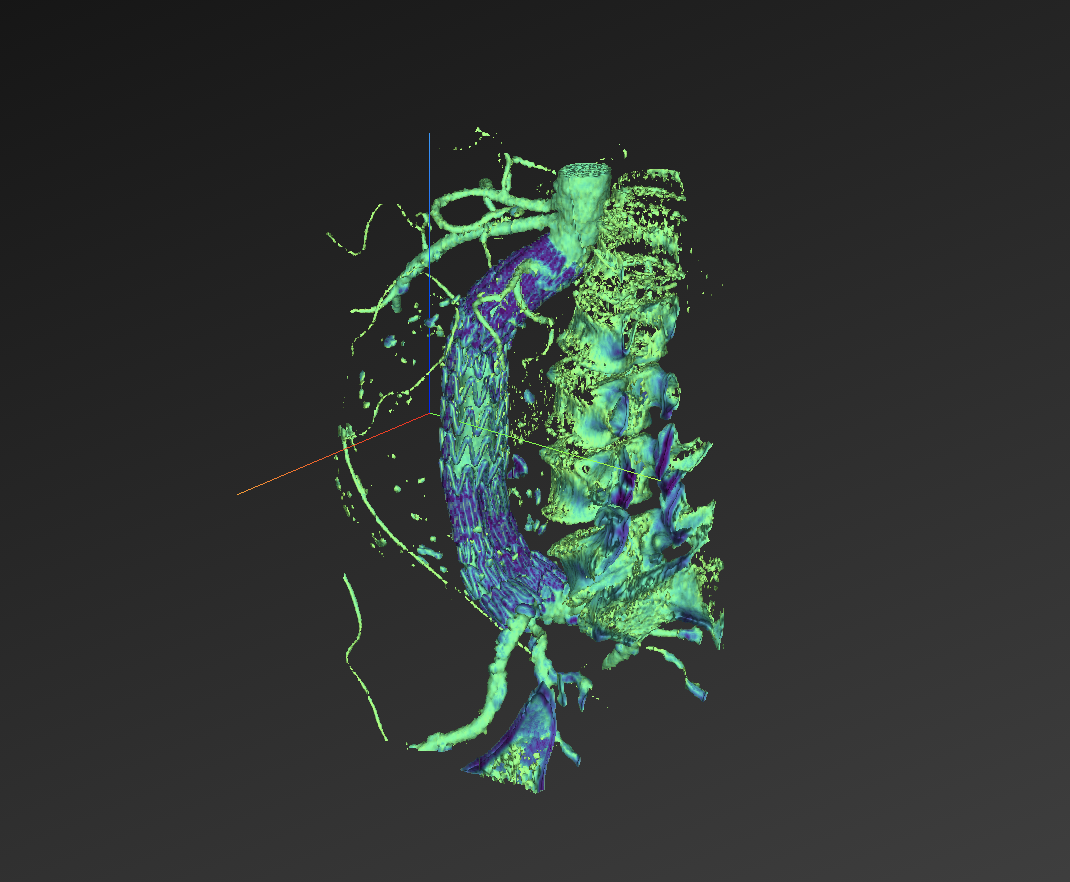 GitHub - theboxahaan/stre-ami-ing: Volume Rendering streaming .nrrd ...