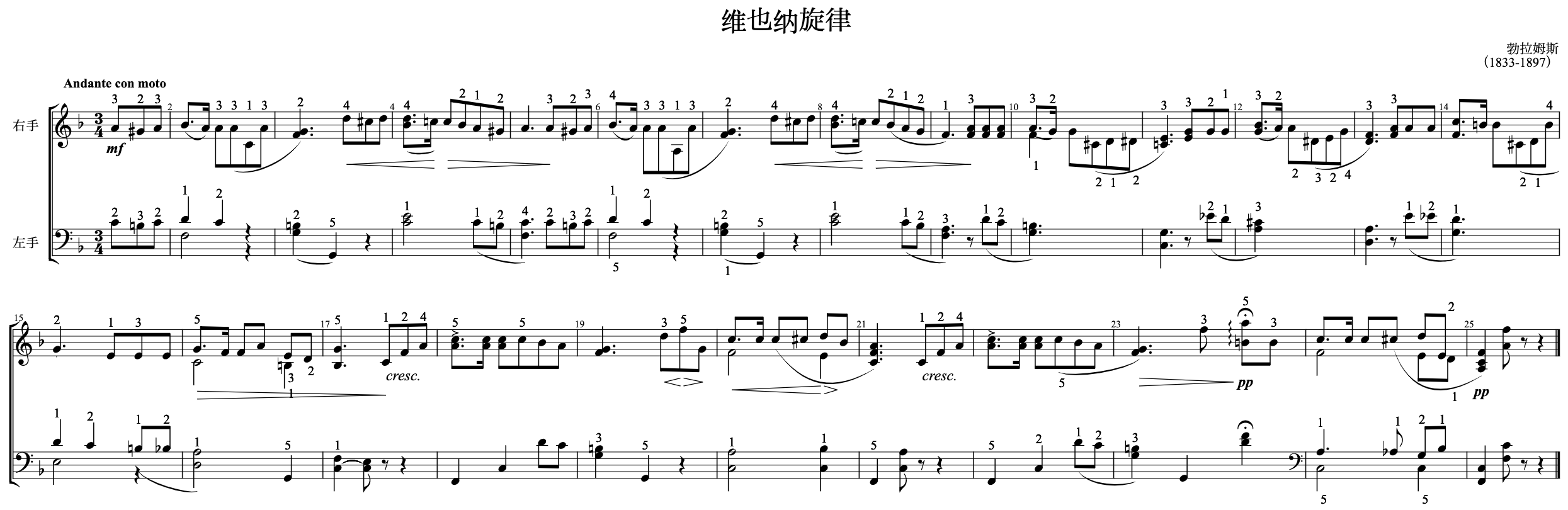 note beam and height · Issue #954 · opensheetmusicdisplay ...