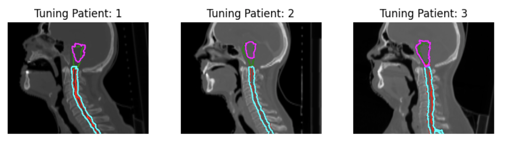 GitHub - CatalinOAlexandru/Multi-Atlas-Segmentation-Image-Registration ...