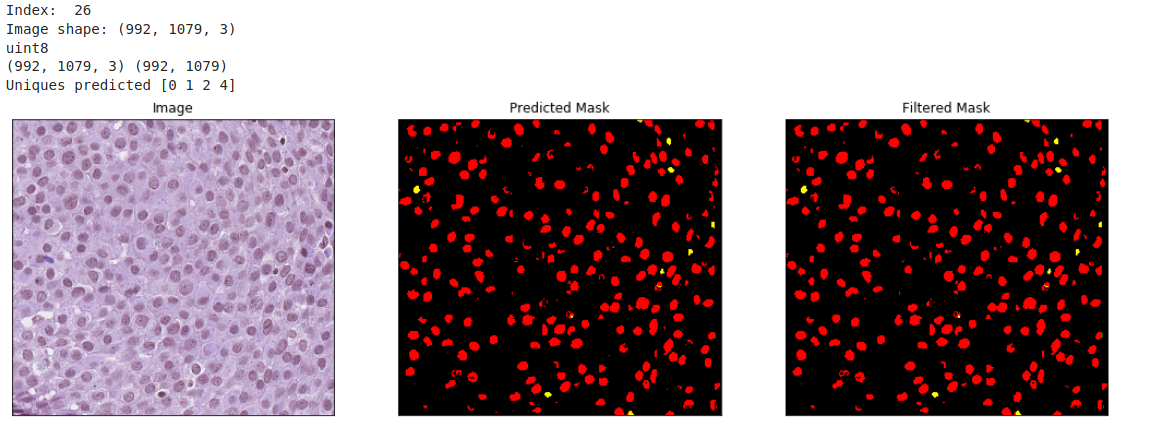 Blas GEMM launch failed · Issue #17 · hasibzunair/MoNuSAC-ISBI-2020 · GitHub