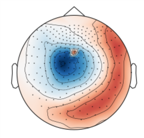 ENH topomap validation and bad channels · Issue #5735 · mne-tools/mne-python · GitHub