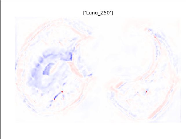 about 'Get_Jac()' · Issue #3 · dykuang/Medical-image-registration · GitHub