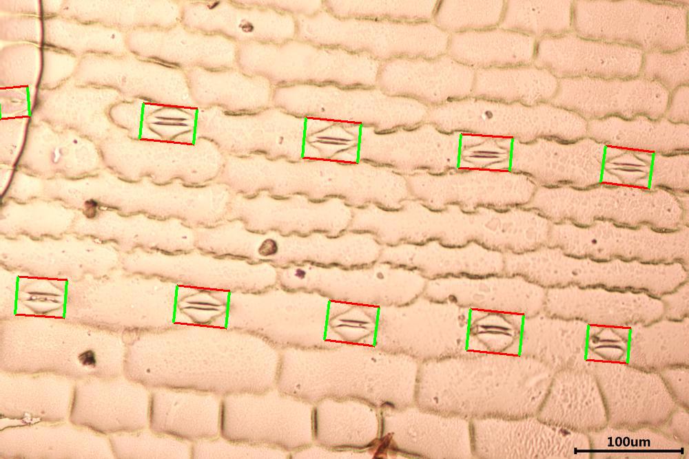Github Sswangbo159357 Rotating Stomata Detection Rotating Stomata Measurement Based On Anchor