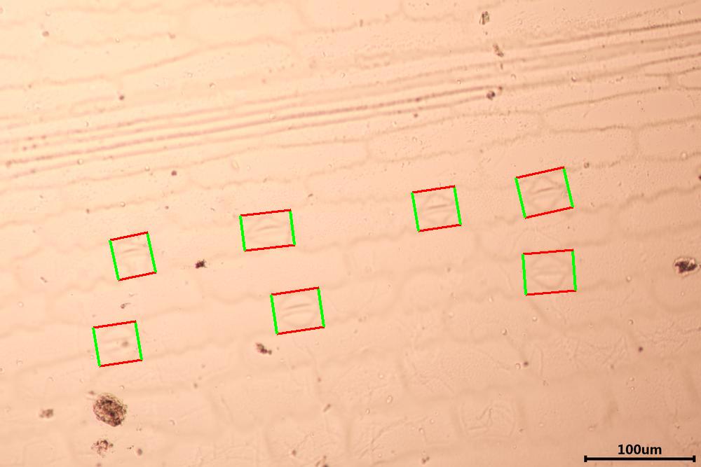 Github Sswangbo159357 Rotating Stomata Detection Rotating Stomata Measurement Based On Anchor