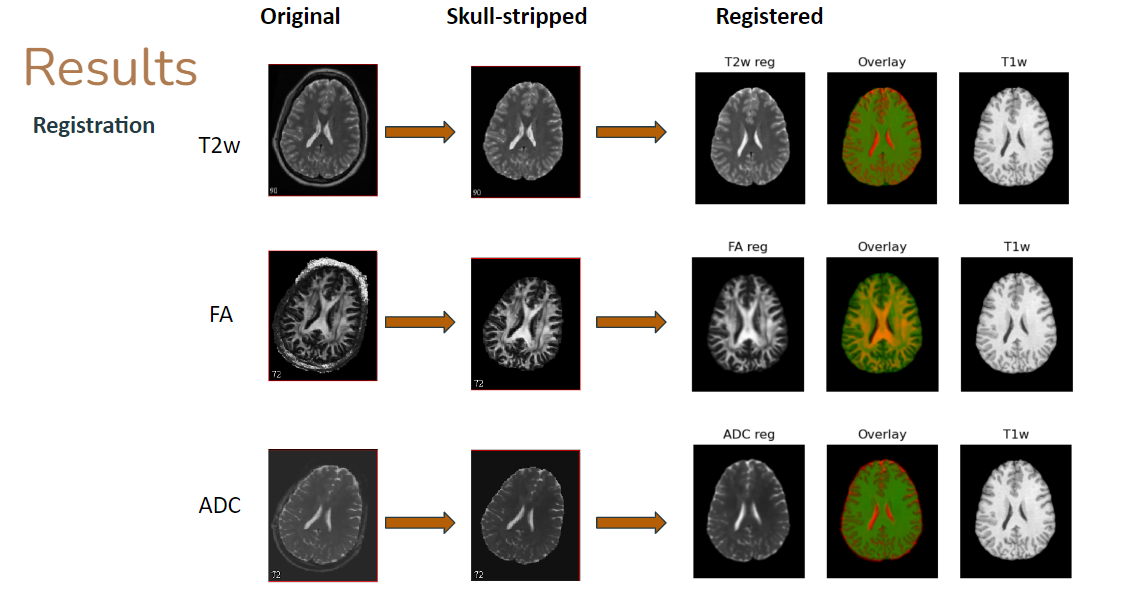 GitHub - nibafanfan/Medical-Image-Analysis-Project: Medical Image ...