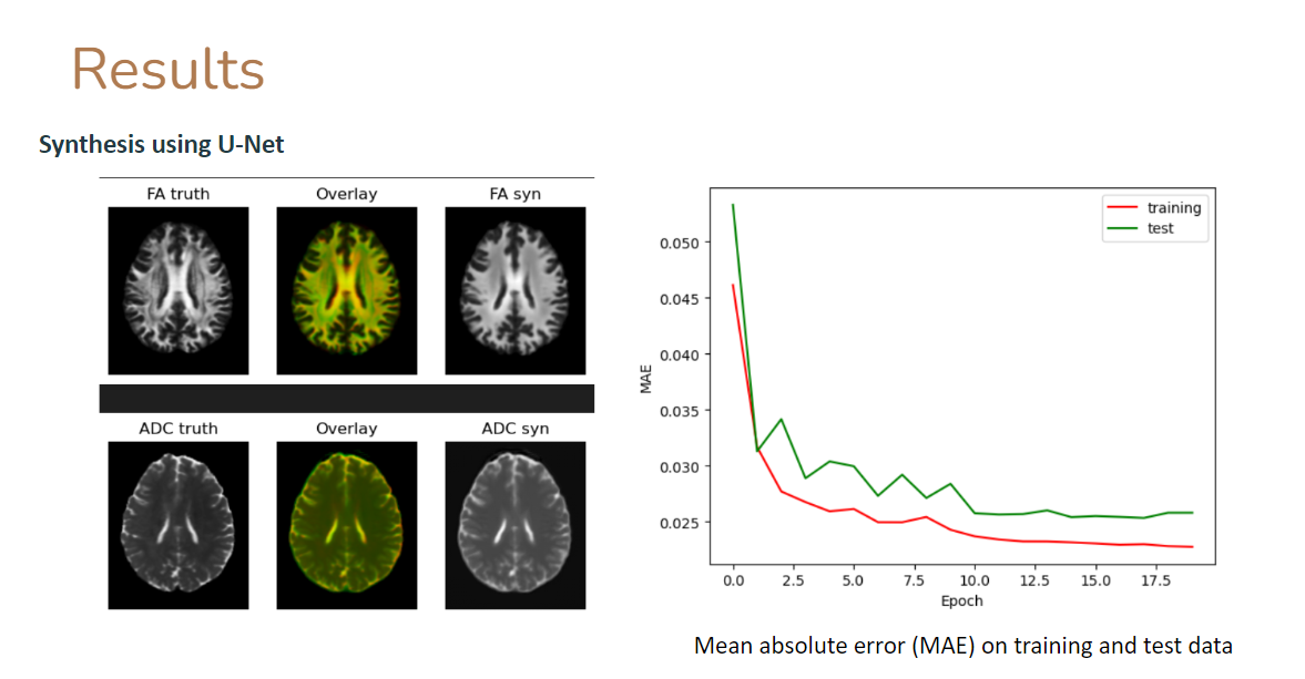 GitHub - nibafanfan/Medical-Image-Analysis-Project: Medical Image Analysis Brain fMRI Synthesis ...