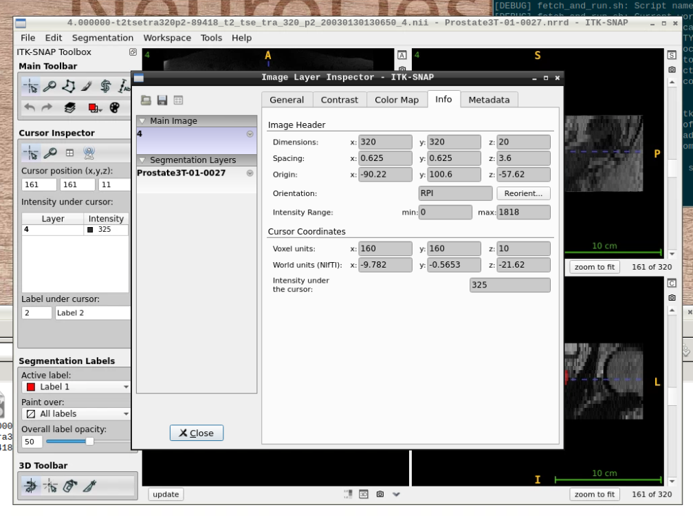 Converting DICOM to nii leads to a different origin · Issue #718 · rordenlab/dcm2niix · GitHub