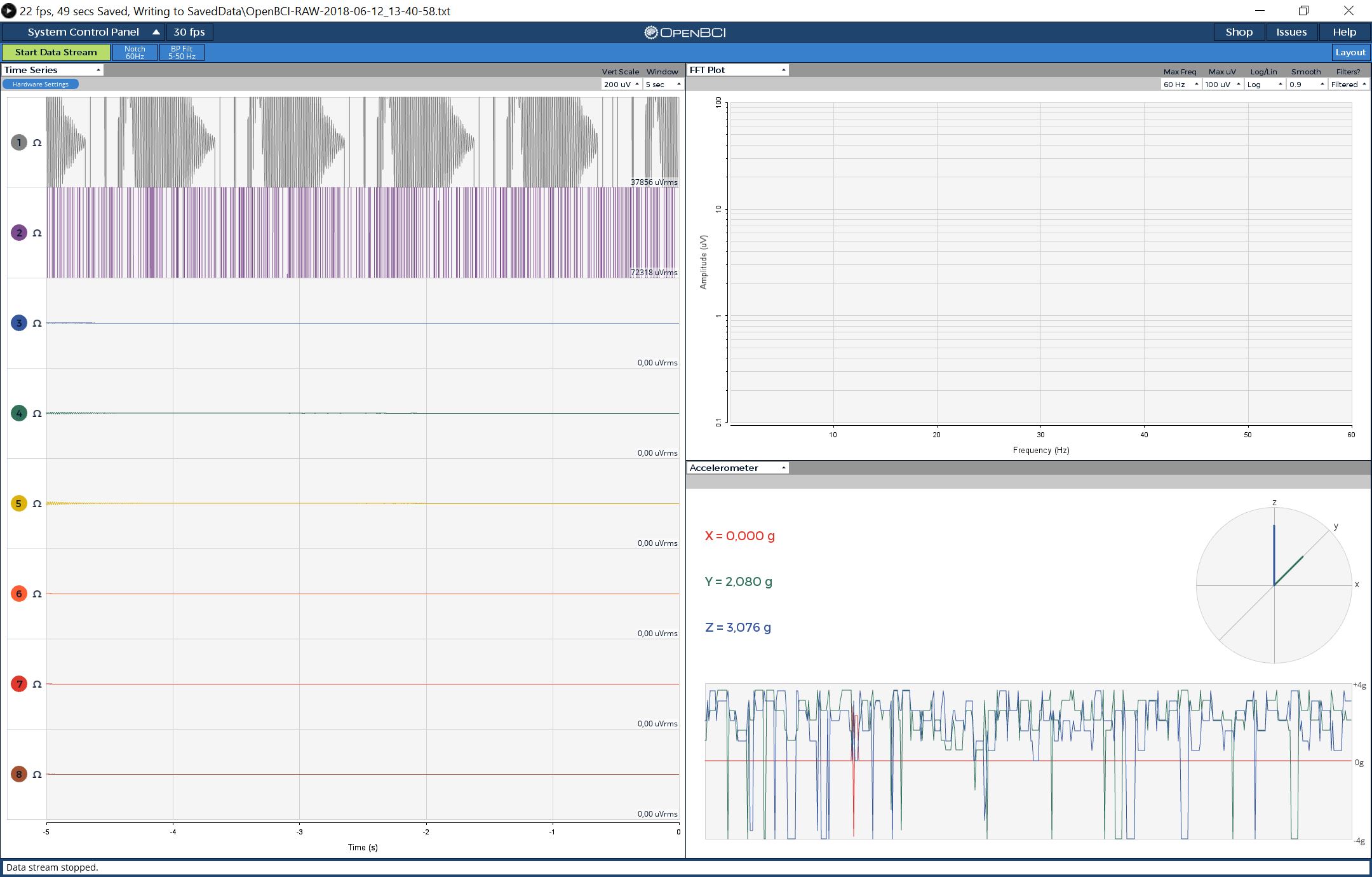 Cyton Board Data Stream Problem · Issue 339 · Openbci Openbci Gui · Github
