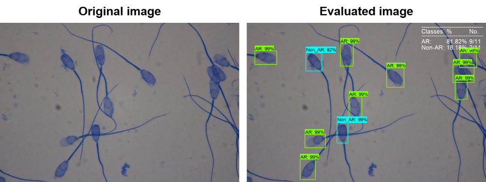 GitHub - knusang1799/acrosome-reaction-classification-system: Acrosome ...