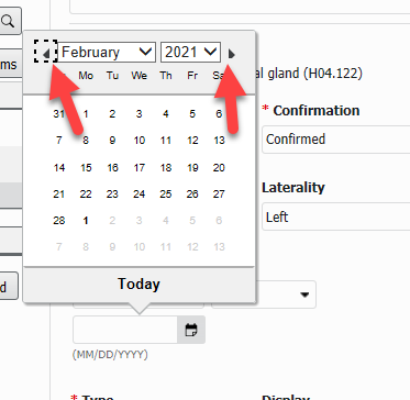 Misaligned arrow controls for IE browser · Issue #1401 · cerner/terra-framework · GitHub
