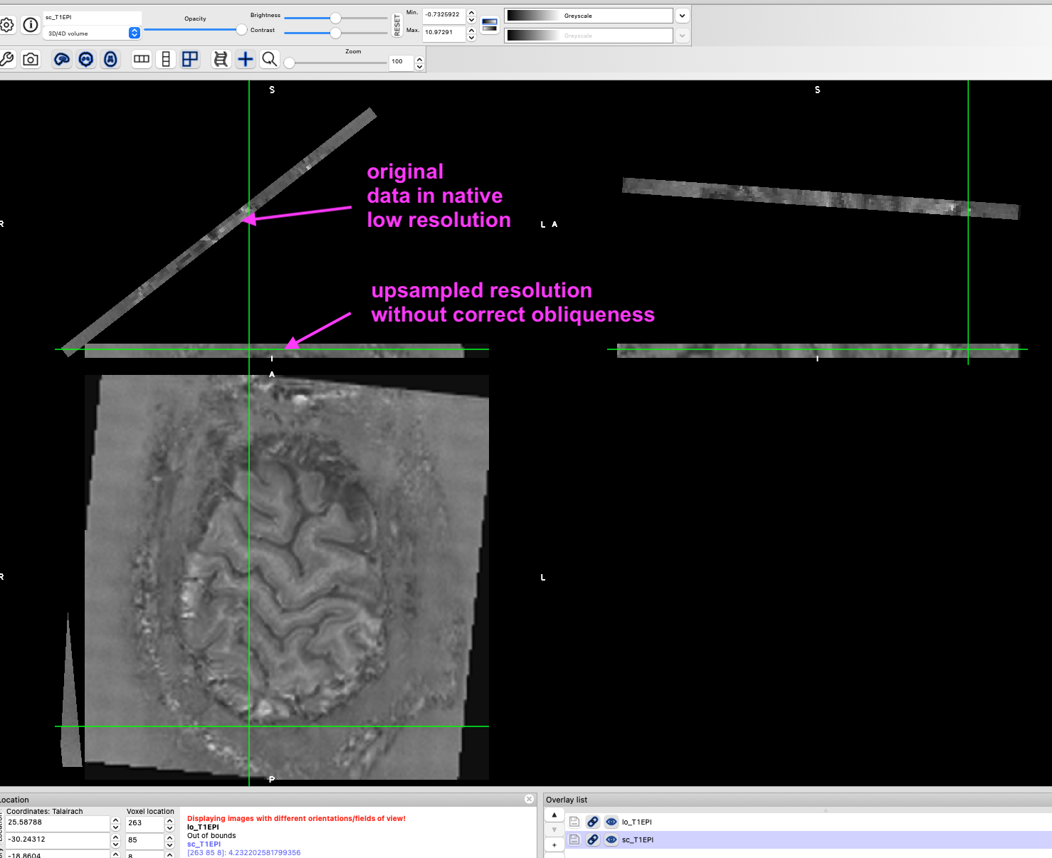 Activation Image resolution Delta bold/vaso exmaple data set · Issue #44 · layerfMRI/LAYNII · GitHub