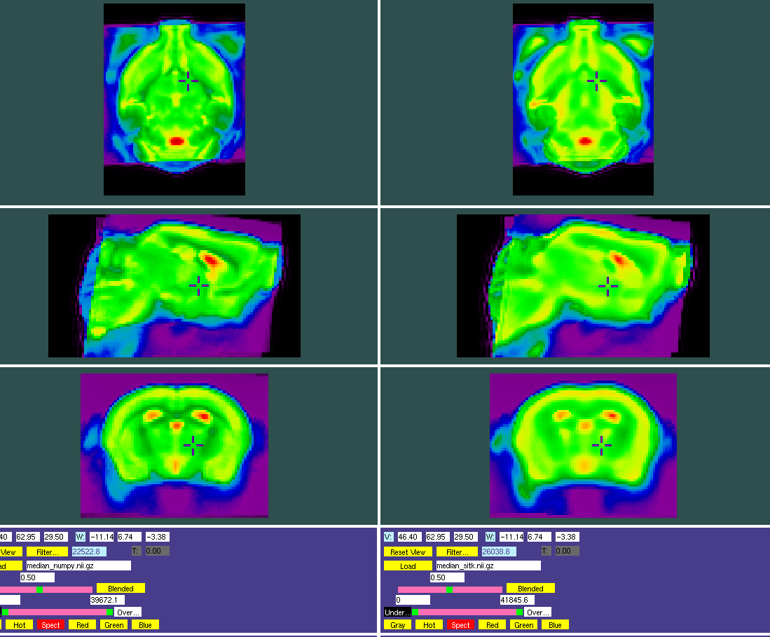 Median averaging through numpy and SimpleITK gives different outputs · Issue #1659 · SimpleITK ...