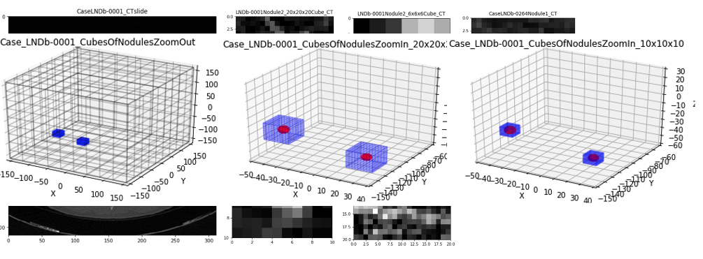 GitHub - btbbtzhang/TumorDetection_in_3DCNNmodel