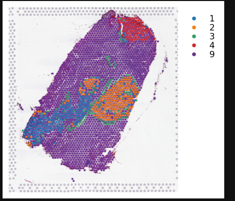 Spatial trajectory inference,when I use stlearn to do seurat cluster ,It meet a mistake? · Issue ...
