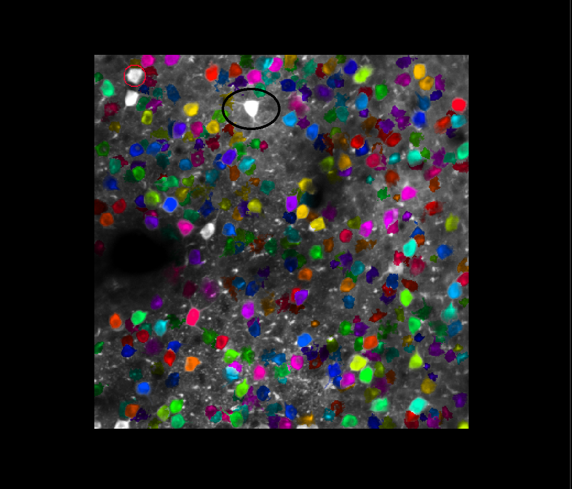 ROI detection--Active cells not detected · Issue #262 · MouseLand/suite2p · GitHub