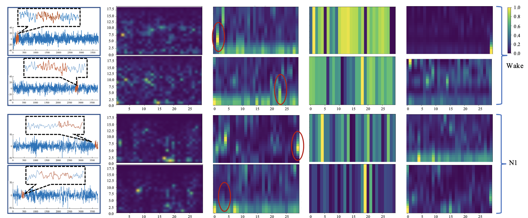 GitHub - chenzRG/TNSRE_23: Automated Sleep Staging via Parallel Frequency-Cut Attention