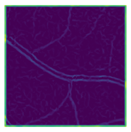 meijering filter artefacts around the image · Issue #4394 · scikit ...