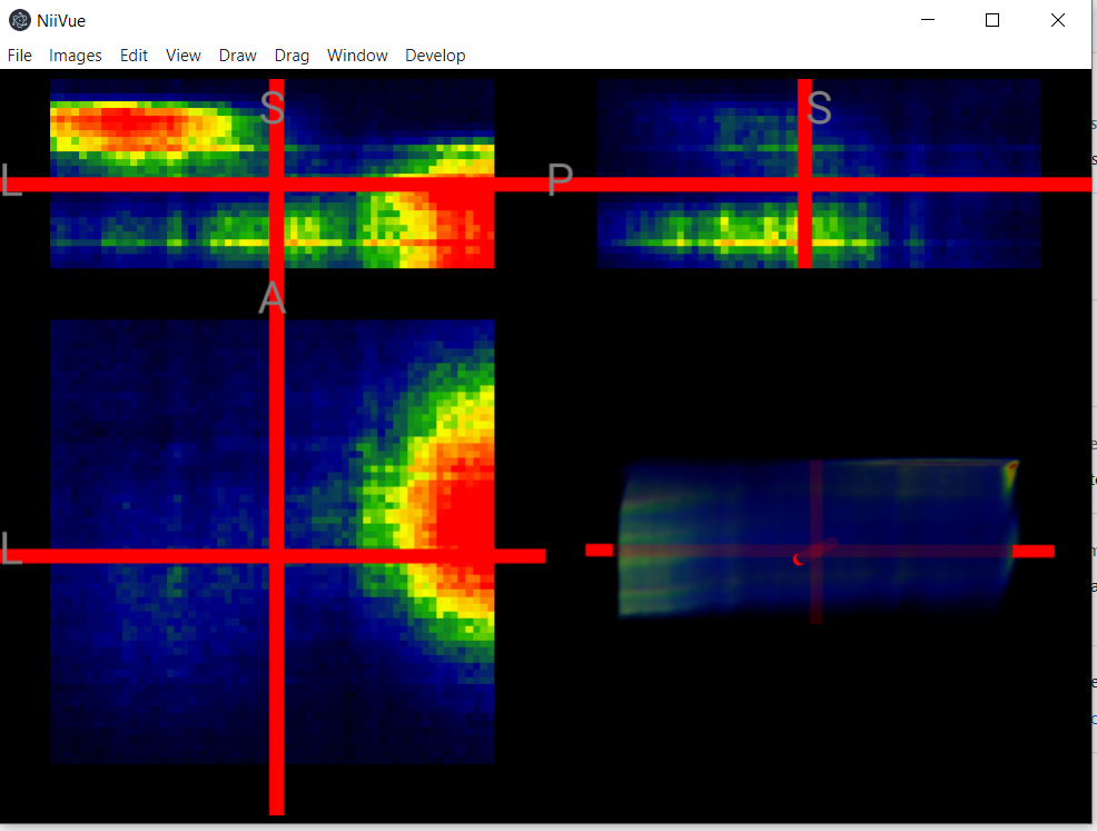 Dynamically load color maps or setting minimum display value for noisy data? · Issue #557 ...