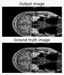 GitHub - AdityaVaradaraj/3D-MRI-CNN-Super-Resolution: CNN-based Super ...