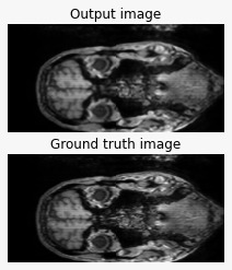 GitHub - AdityaVaradaraj/3D-MRI-CNN-Super-Resolution: CNN-based Super ...