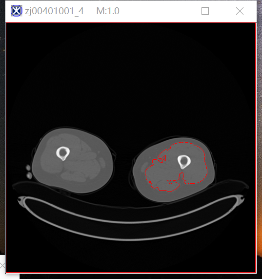 add Level-Set ROI · Issue #339 · cornerstonejs/cornerstoneTools · GitHub