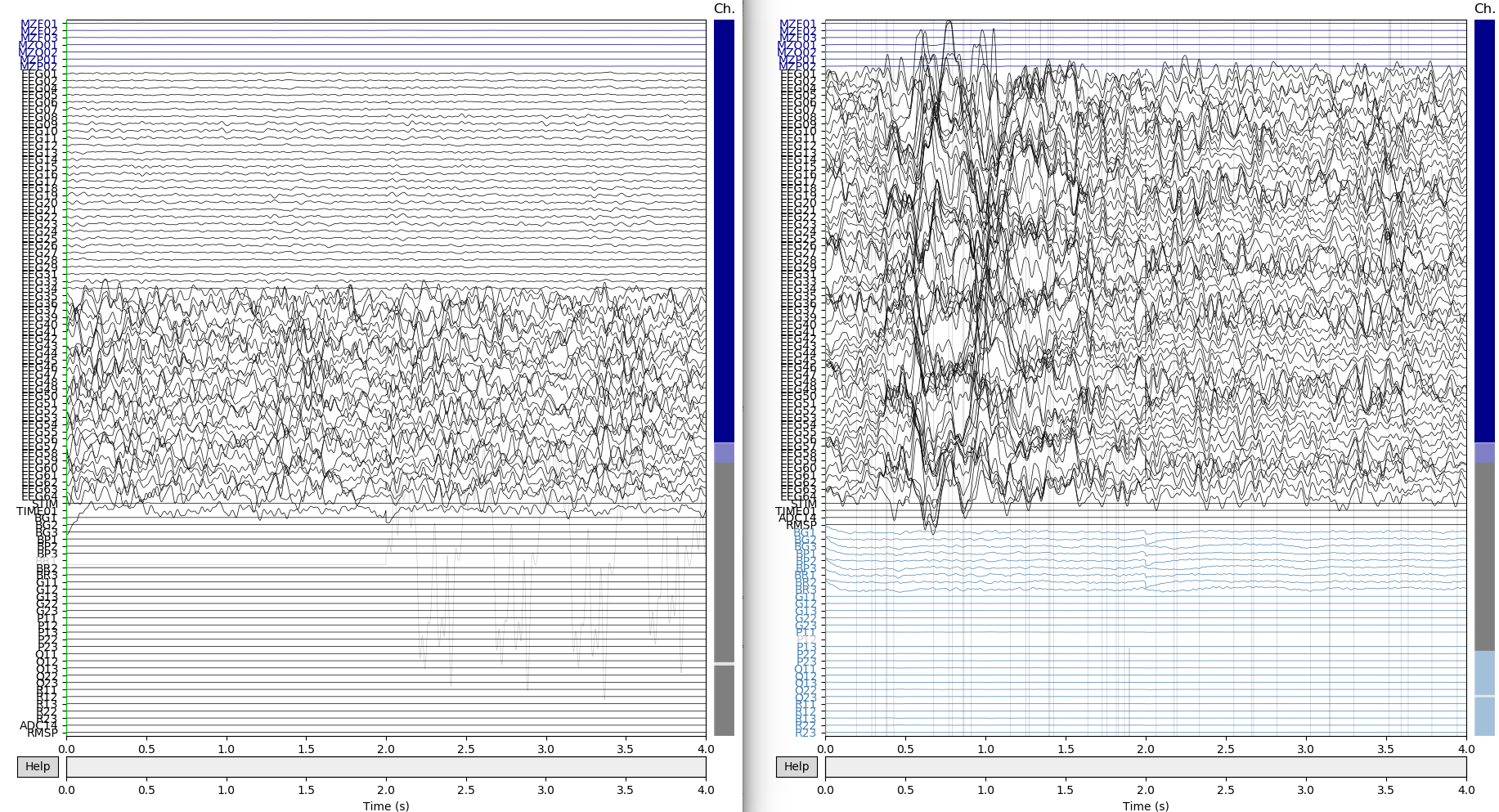Add reader for Curry Files · Issue #5488 · mne-tools/mne-python · GitHub