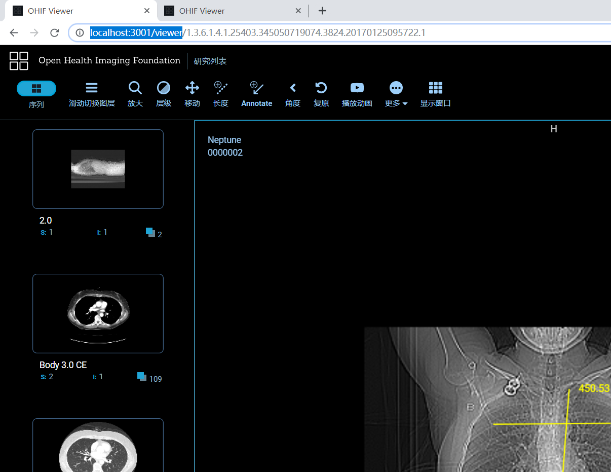 OHIF/Viewers with DICOMcloud not work fine · Issue #76 · DICOMcloud/DICOMcloud · GitHub