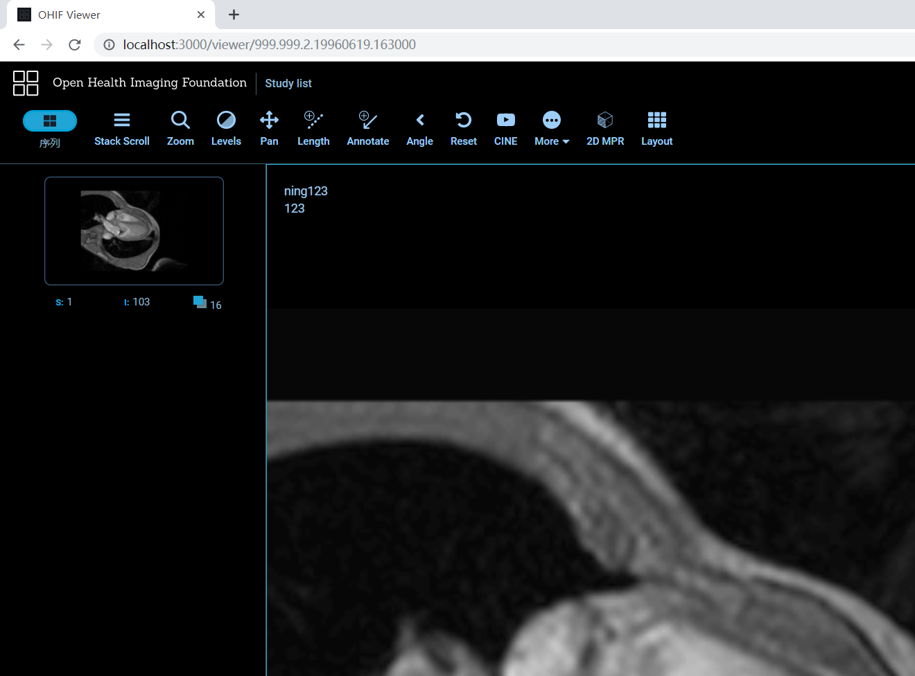 OHIF/Viewers with DICOMcloud not work fine · Issue #76 · DICOMcloud/DICOMcloud · GitHub
