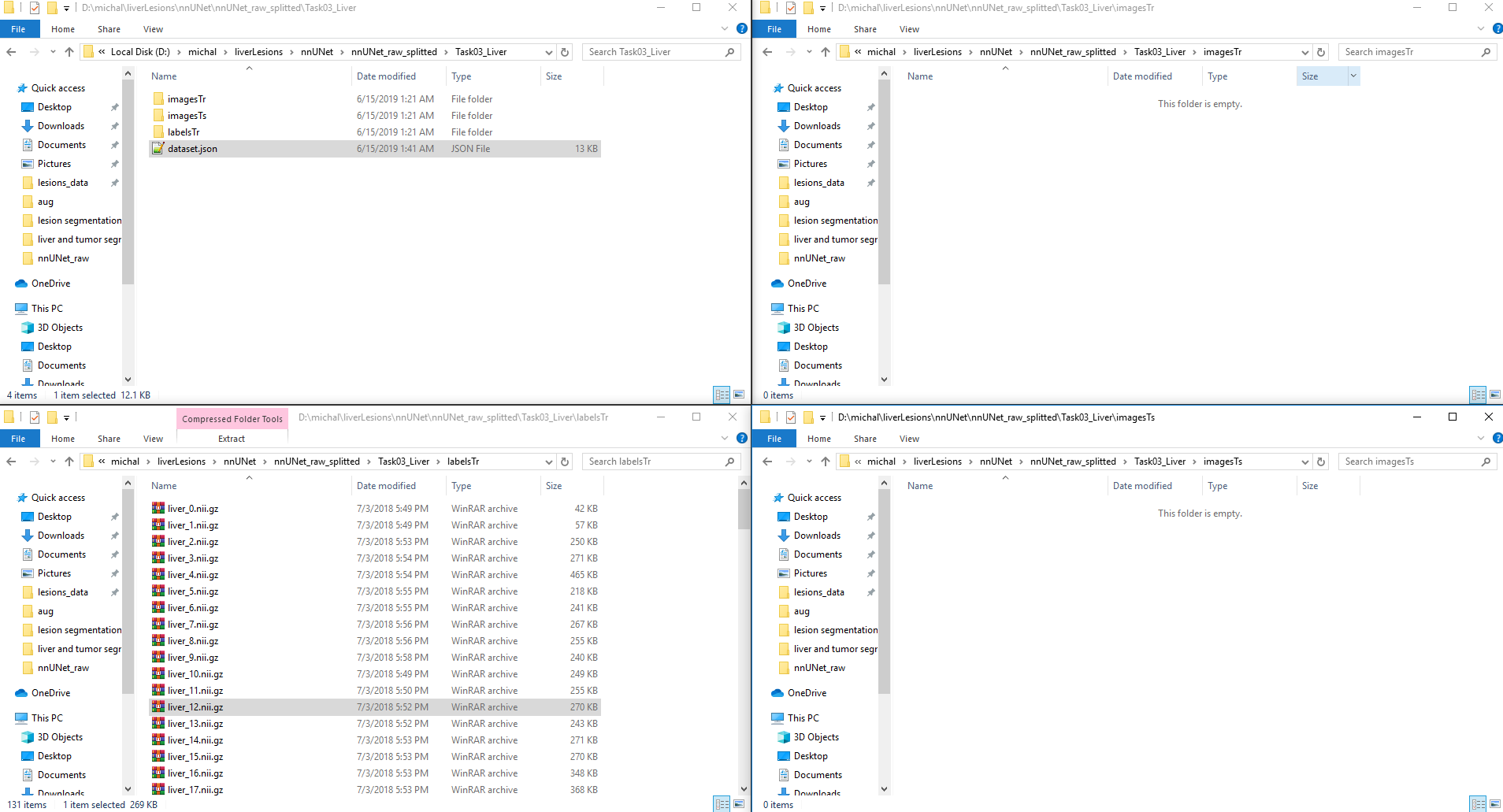 self.dataset_properties['all_spacings'] is empty · Issue #18 · MIC-DKFZ/nnUNet · GitHub