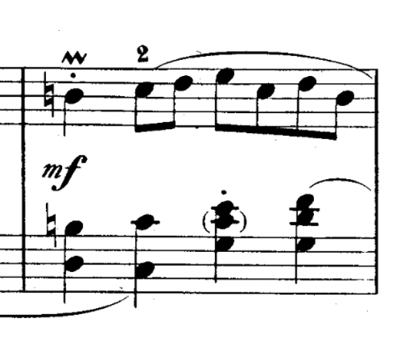 enclosed noteheads · Issue #672 · music-encoding/music-encoding · GitHub