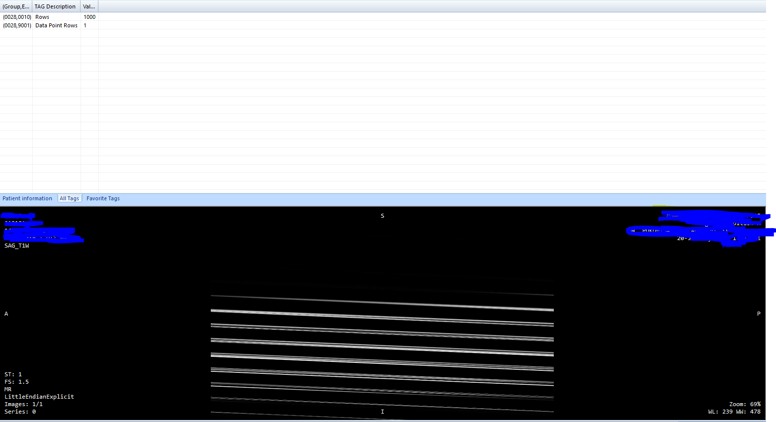 Rescale Dicom Slice Quality Or Reduce Number Of Cols And Rows · Issue 8400