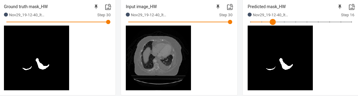 Github Ltvnsergey Pleural Effusion Detection Detect Pleural Effusion