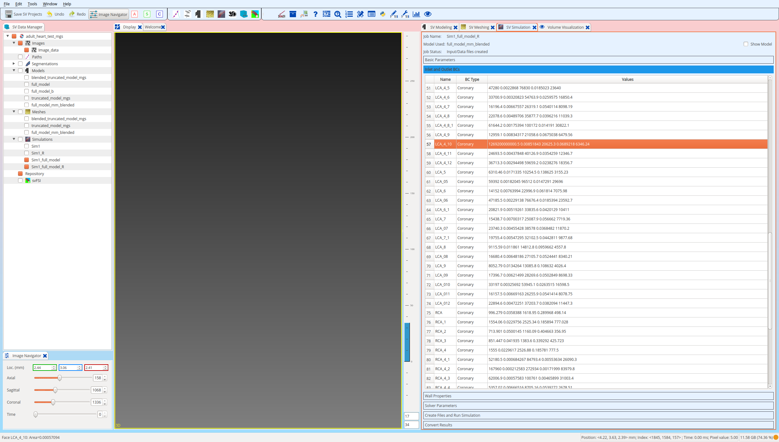 Coronary boundary condition bug · Issue #415 · SimVascular/SimVascular · GitHub