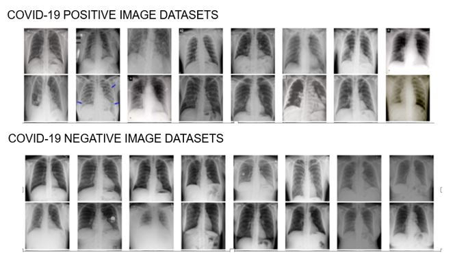 GitHub - Vishnudev99/Covid-19-Detection: this is a web app for the ...