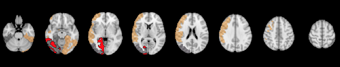 Rendering png figure with semi-transparent overlay "deletes" underlay ...