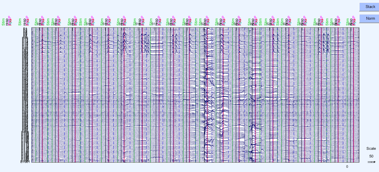Show trial number at bottom of `eegplot()` · Issue #107 · sccn/eeglab · GitHub