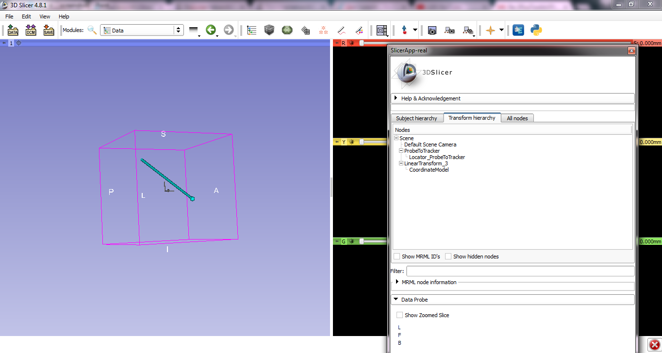 Developing the configuration file · Issue #319 · PlusToolkit/PlusLib · GitHub