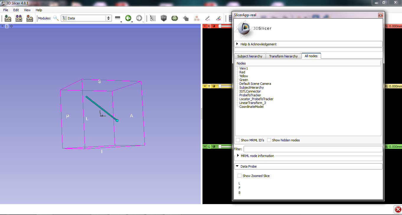 Developing the configuration file · Issue #319 · PlusToolkit/PlusLib · GitHub