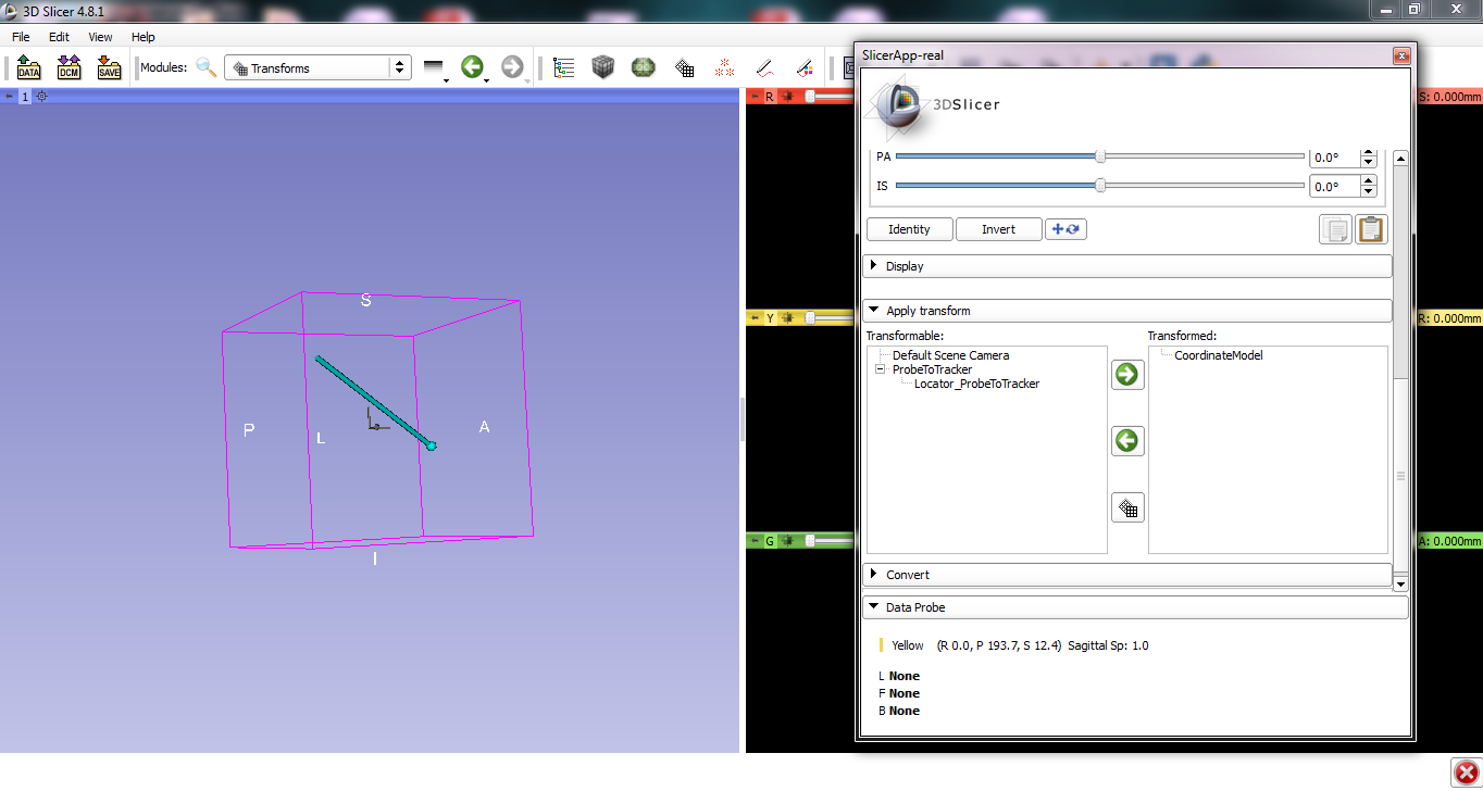 Developing the configuration file · Issue #319 · PlusToolkit/PlusLib · GitHub