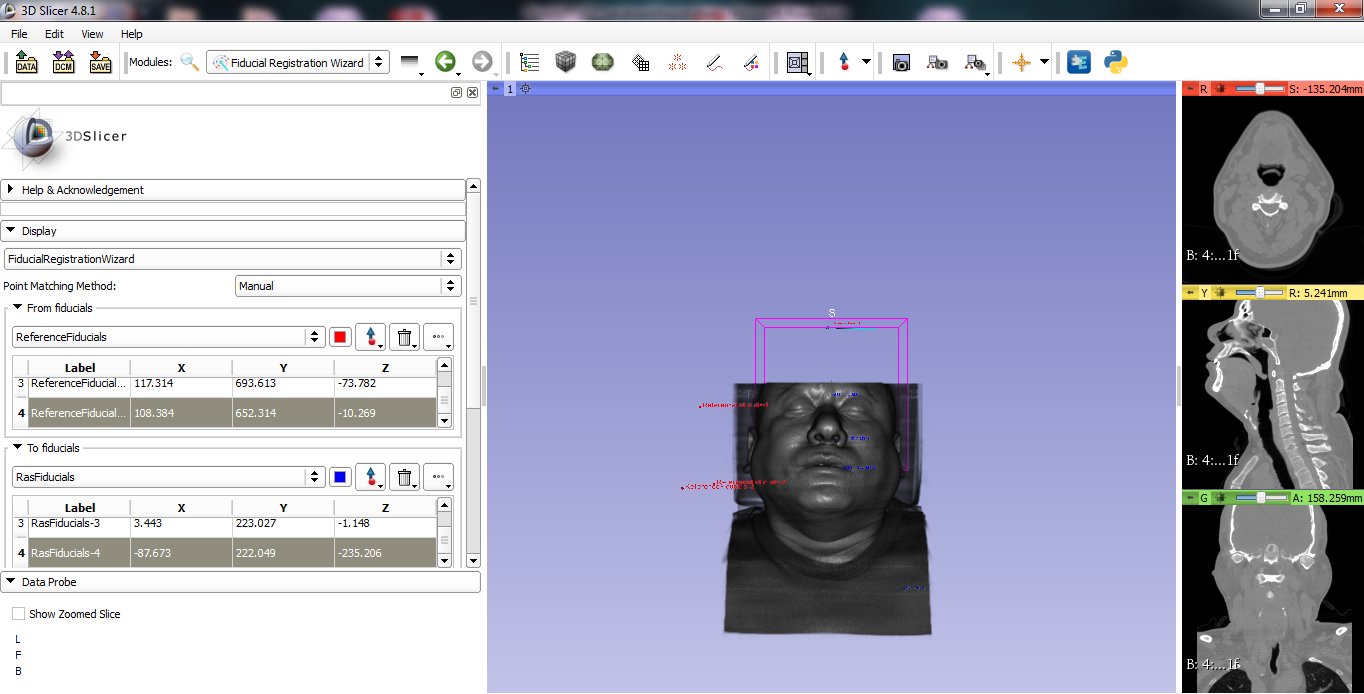 Developing the configuration file · Issue #319 · PlusToolkit/PlusLib · GitHub