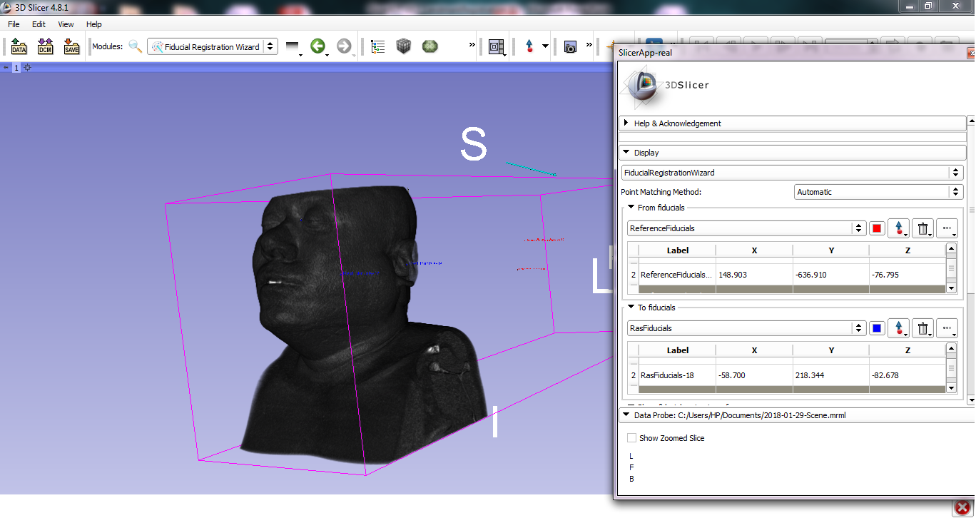 Developing the configuration file · Issue #319 · PlusToolkit/PlusLib · GitHub