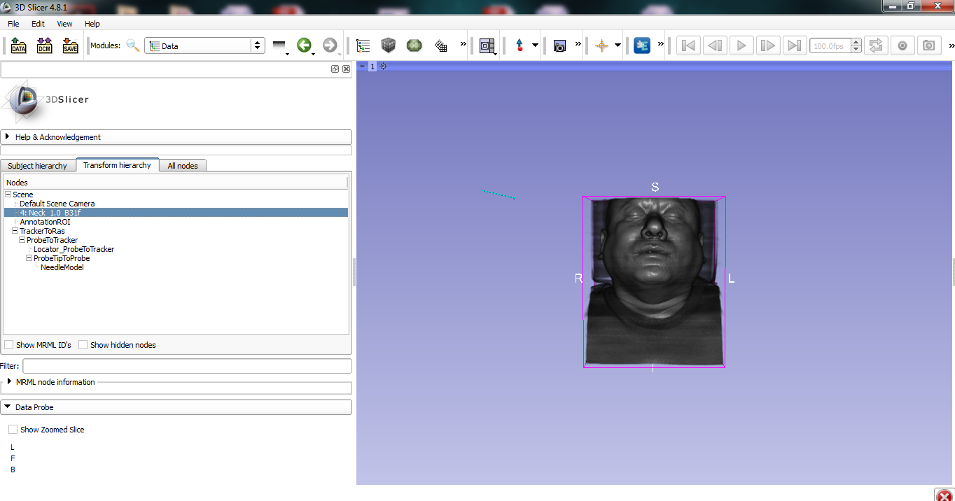 Developing the configuration file · Issue #319 · PlusToolkit/PlusLib · GitHub