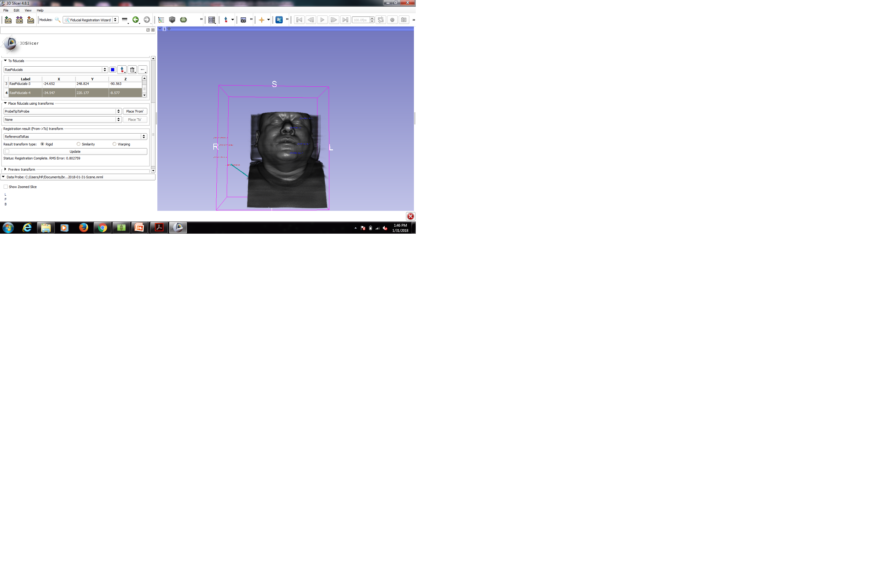 Developing the configuration file · Issue #319 · PlusToolkit/PlusLib · GitHub