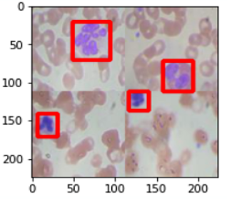 GitHub - SSt6708/Blood-Cell-Pooling-and-Classification