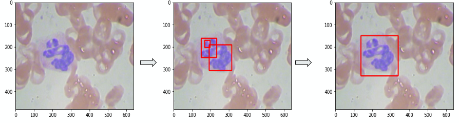 GitHub - SSt6708/Blood-Cell-Pooling-and-Classification