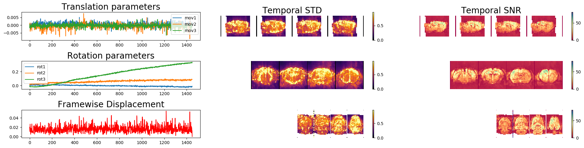 Error running confound_regression with ica_aroma · Issue #145 · CoBrALab/RABIES · GitHub